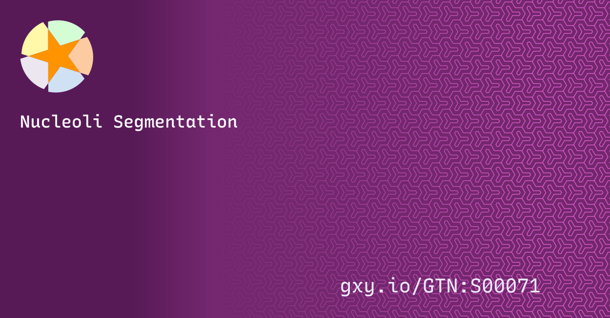 Nucleoli Segmentation & Feature Extraction using CellProfiler